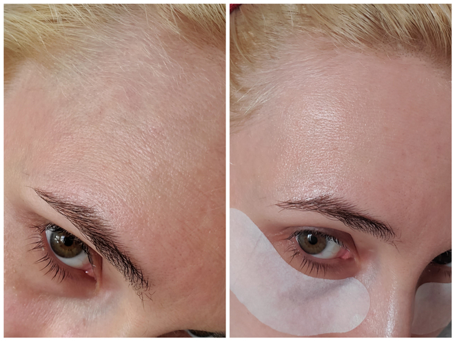 От лёгкого ожога за ночь и от проблем на коже за 1 неделю: крем c Wow ...